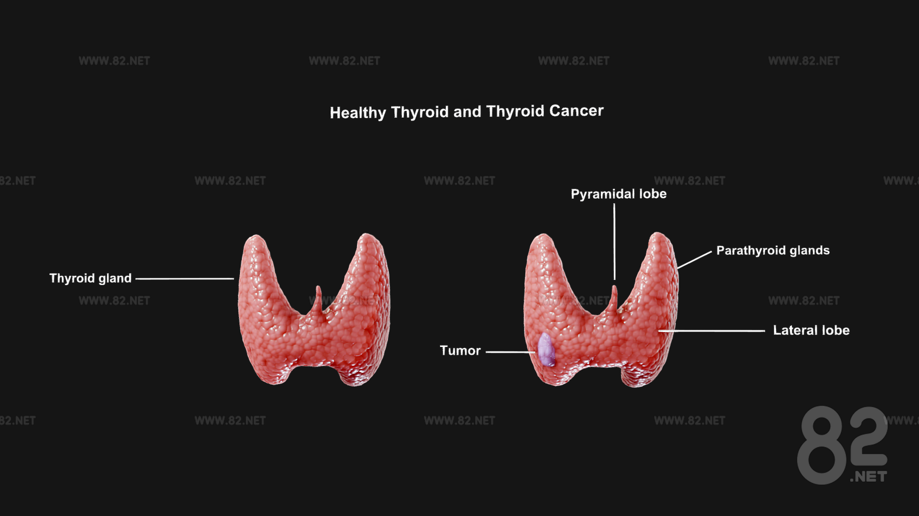 tonsil thyroid 3d Model fbx max obj | 82Models